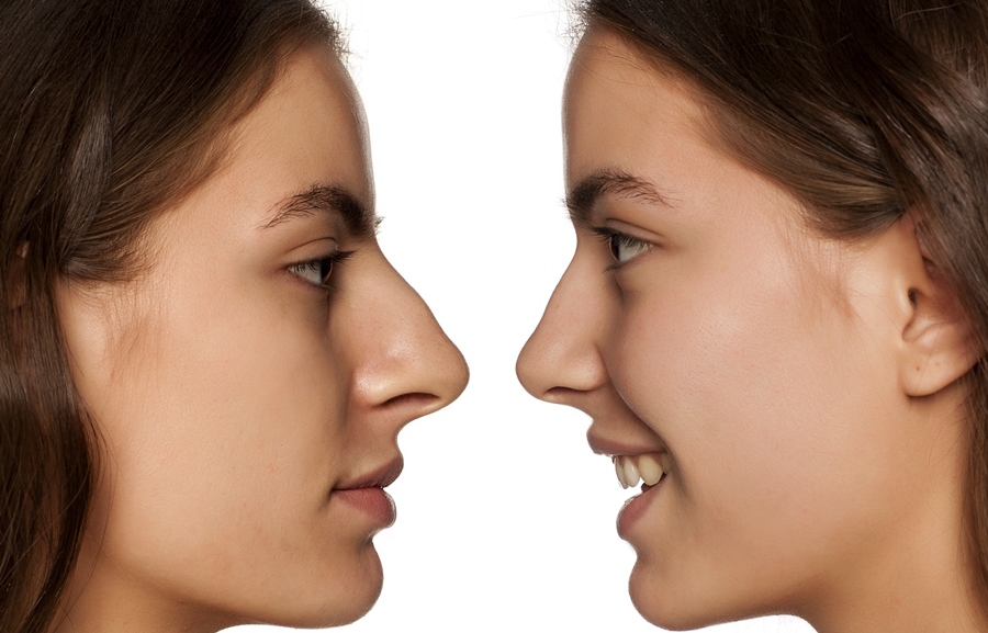 Ethnic Plastic Surgery: Comparing the East and the West Techniques