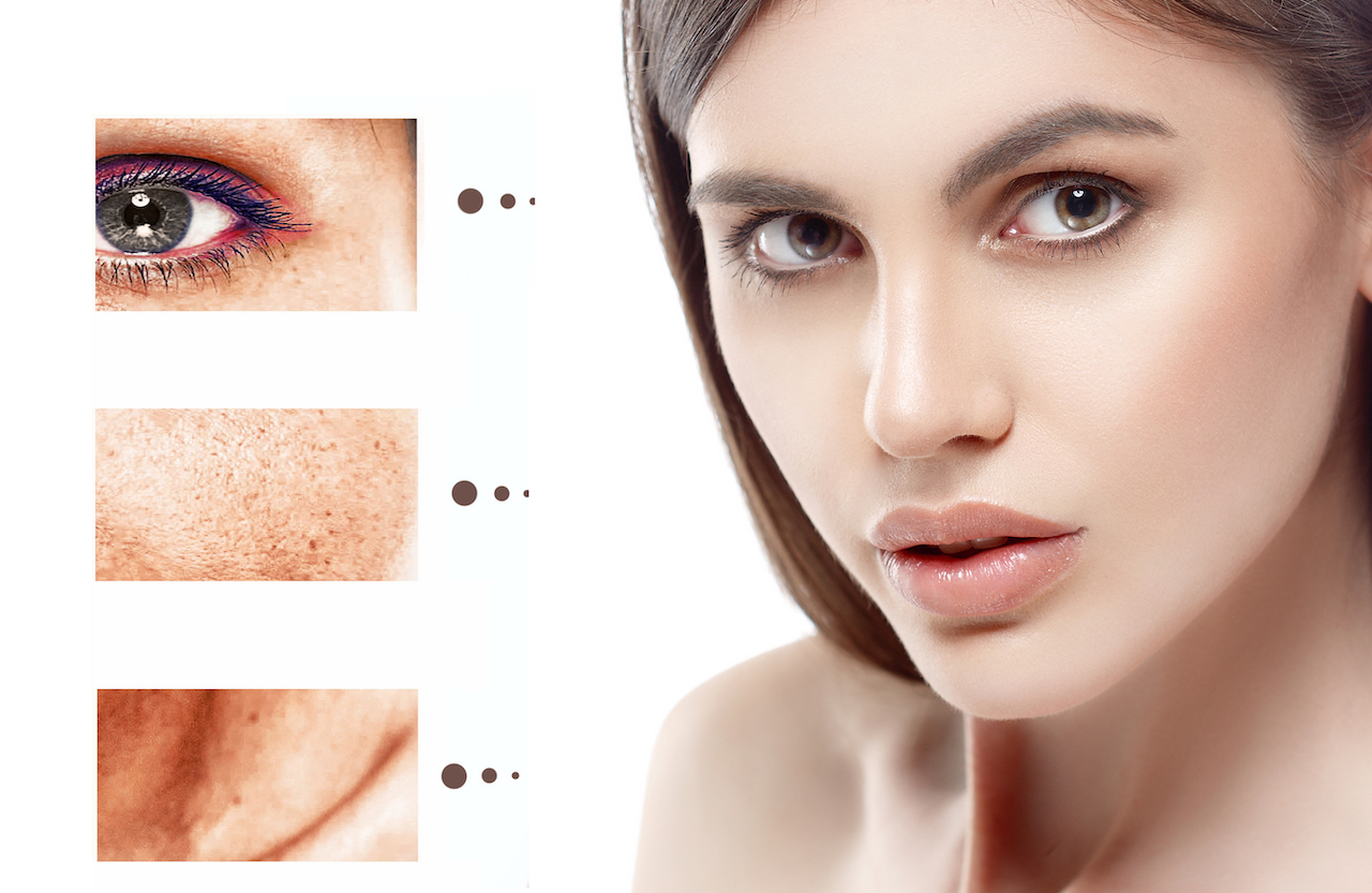 Dark Spots Treatments That Promise Results - The Beautiful Lifestyle