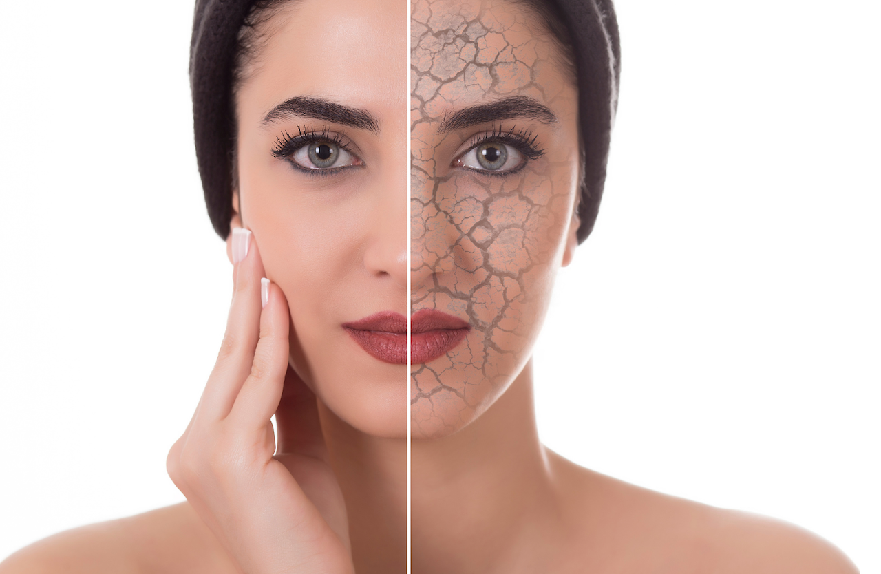 Naturally Sad-looking Face: Possible Causes and Treatments